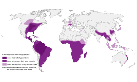 Histoplasma capsulatum - IDWiki